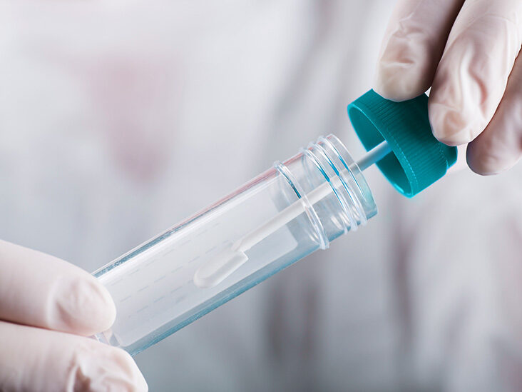 Punkt pobrań – badania kału - Centrum Medyczne Wilsona